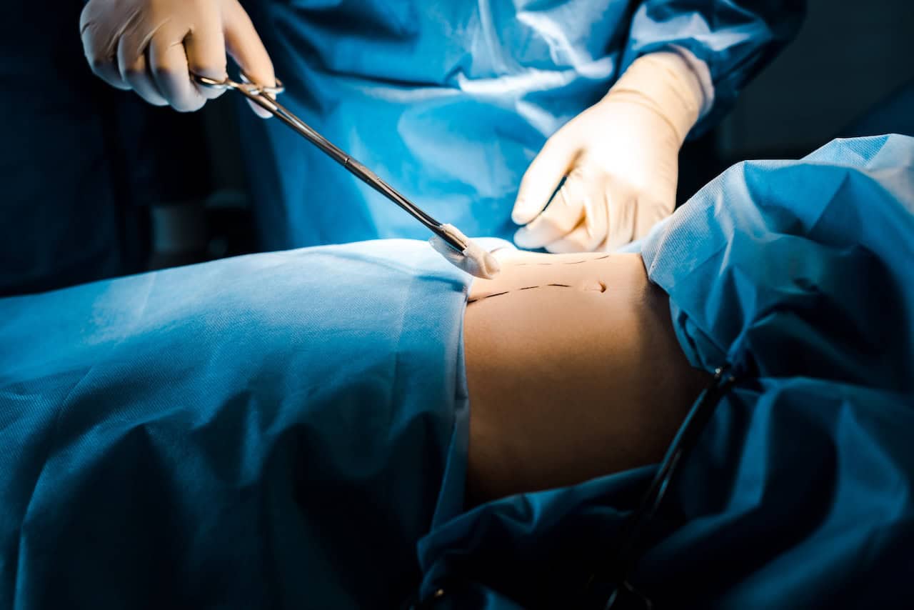 Plastic Surgery Procedures You Can Combine with Liposuction